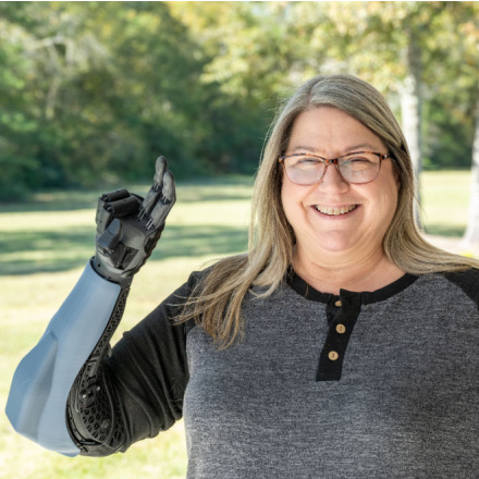 The Hero Arm is a Prosthetic Arm Made by Open Bionics