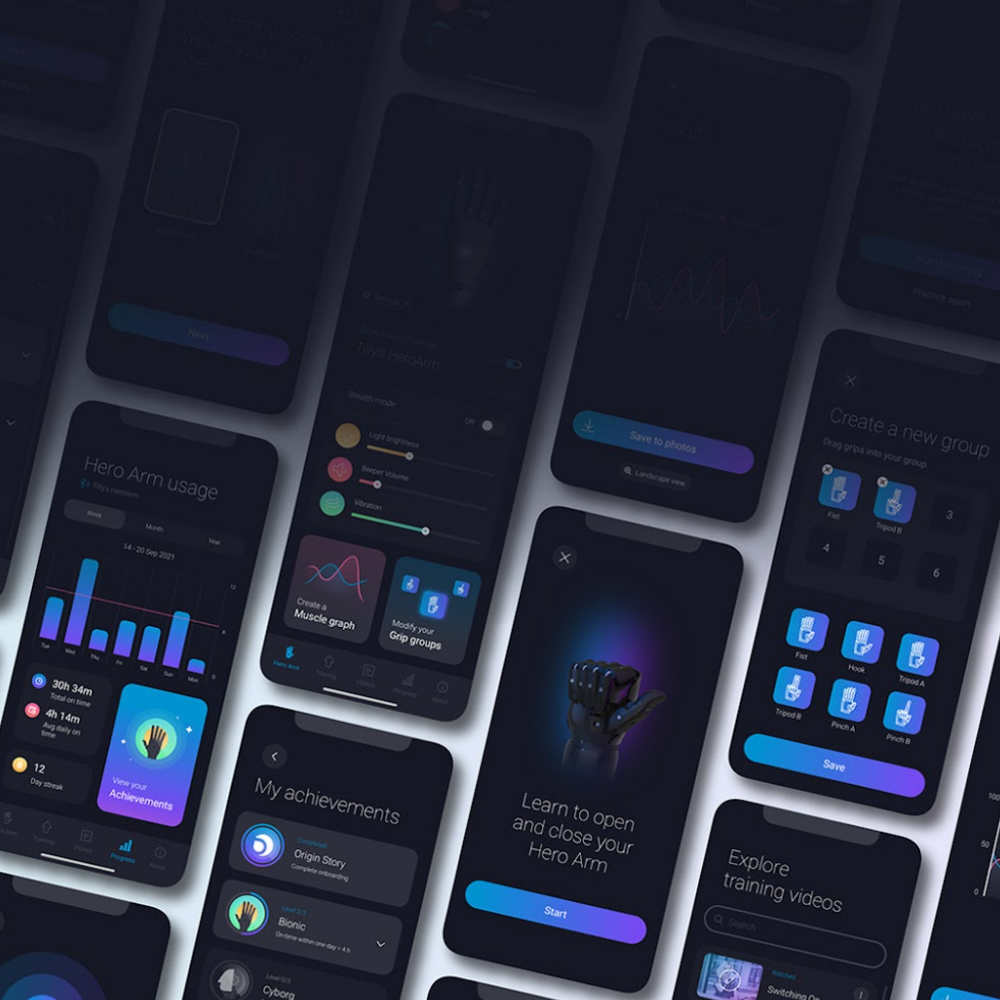 Open Bionics - Turning Disabilities into Superpowers